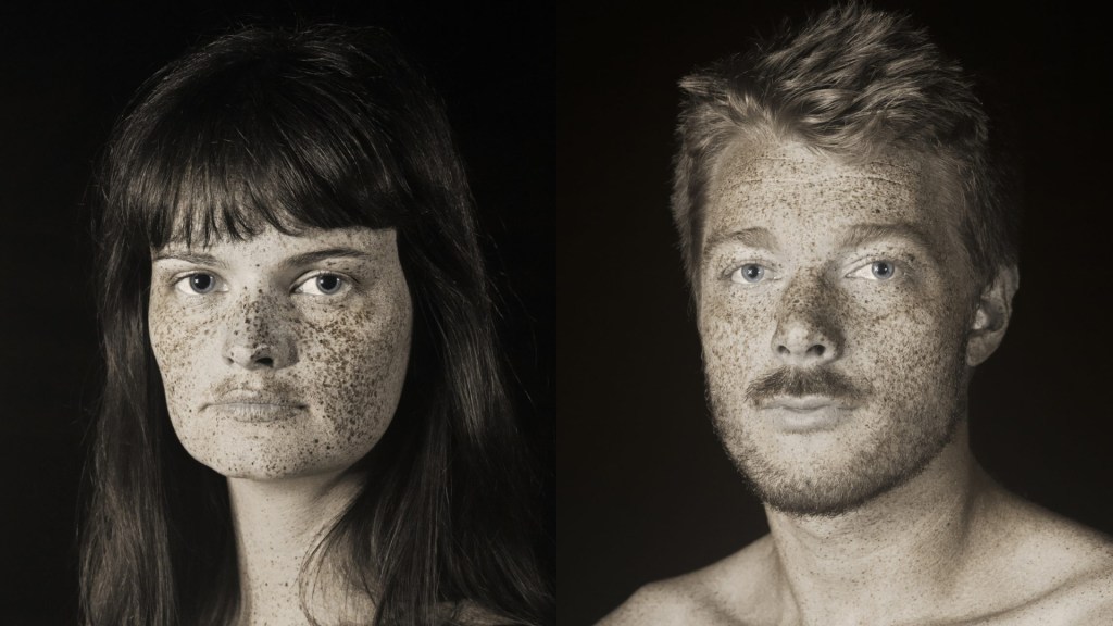 this photographer makes a good case for wearing spf this summer