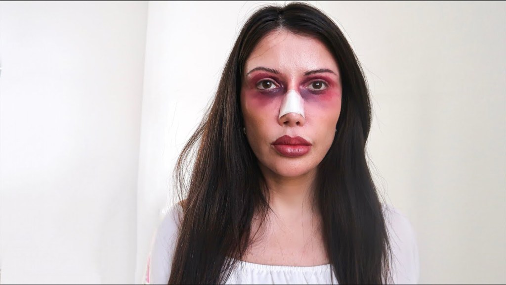 The curious rise of botched plastic surgery videos